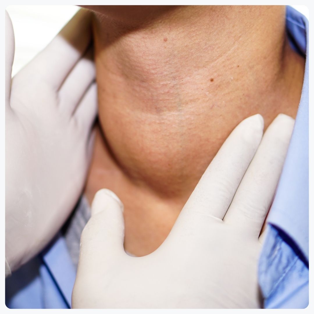 Denizli Tiroid Bezi (Guatr) Tedavisi - Fizyorad Tıp Merkezi